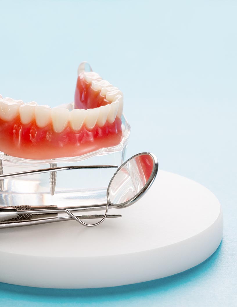 Dental Bone Graft Substitutes Market Forecast 2021-2025